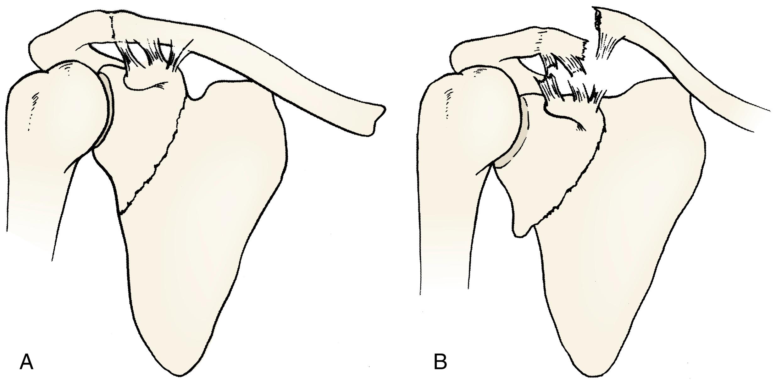 Upper Extremity Injuries - Clinical Tree