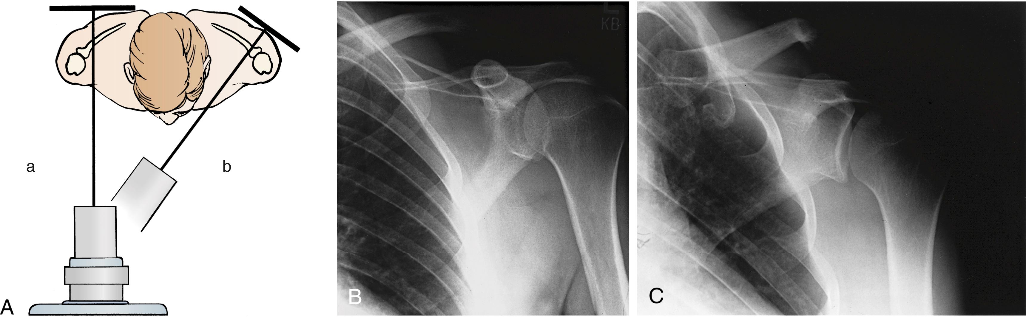 Upper Extremity Injuries - Clinical Tree