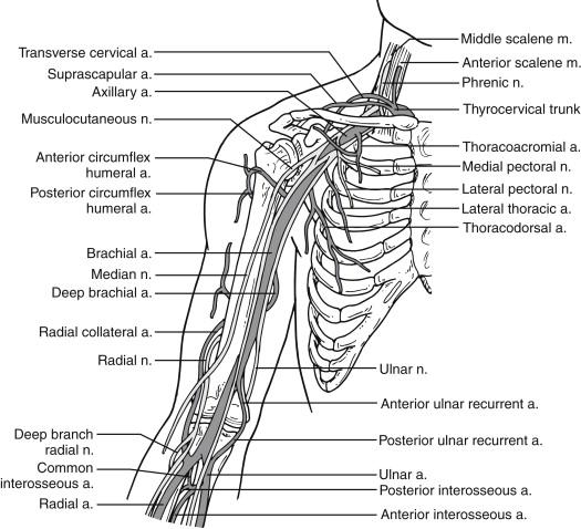 Upper Extremity Revascularization - Clinical Tree