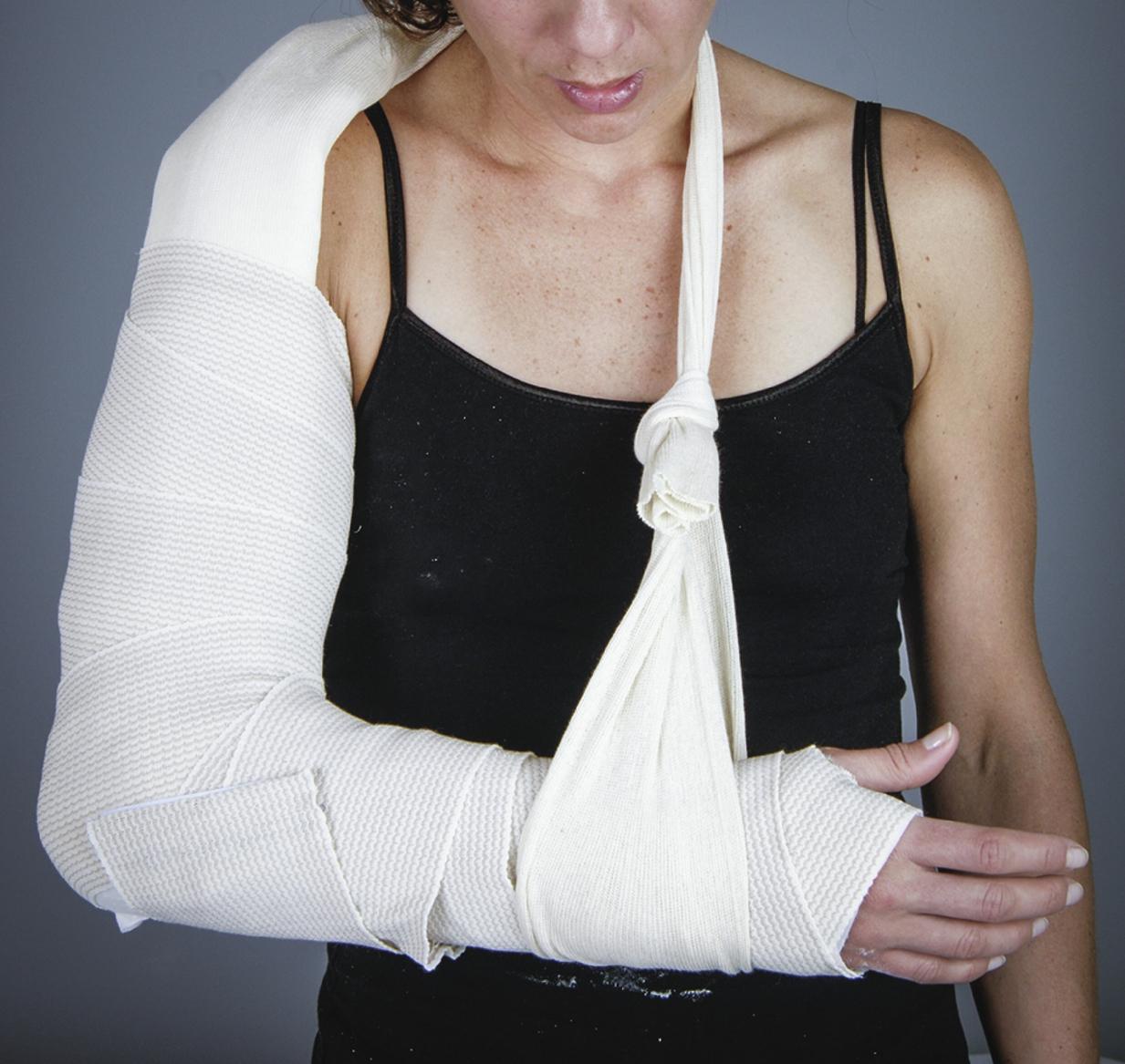 Upper Extremity Splints and Casts - Clinical Tree