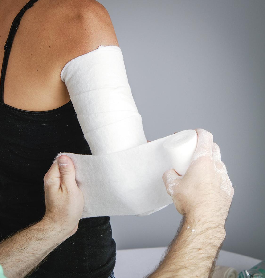 Upper Extremity Splints and Casts - Clinical Tree