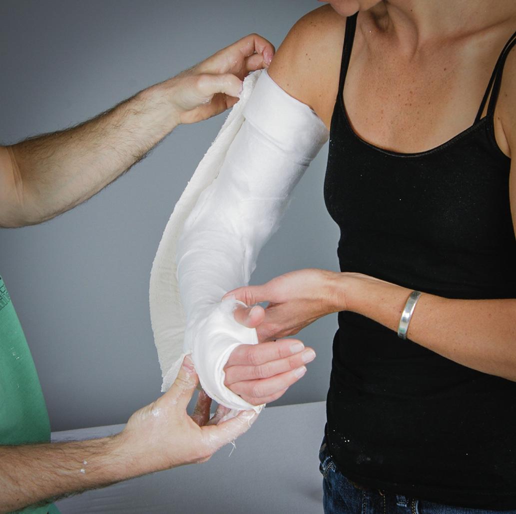 Upper Extremity Splints and Casts - Clinical Tree