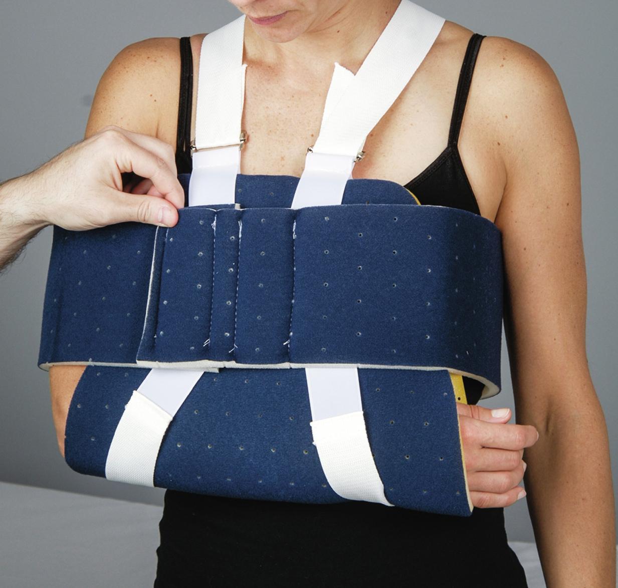 Upper Extremity Splints and Casts - Clinical Tree