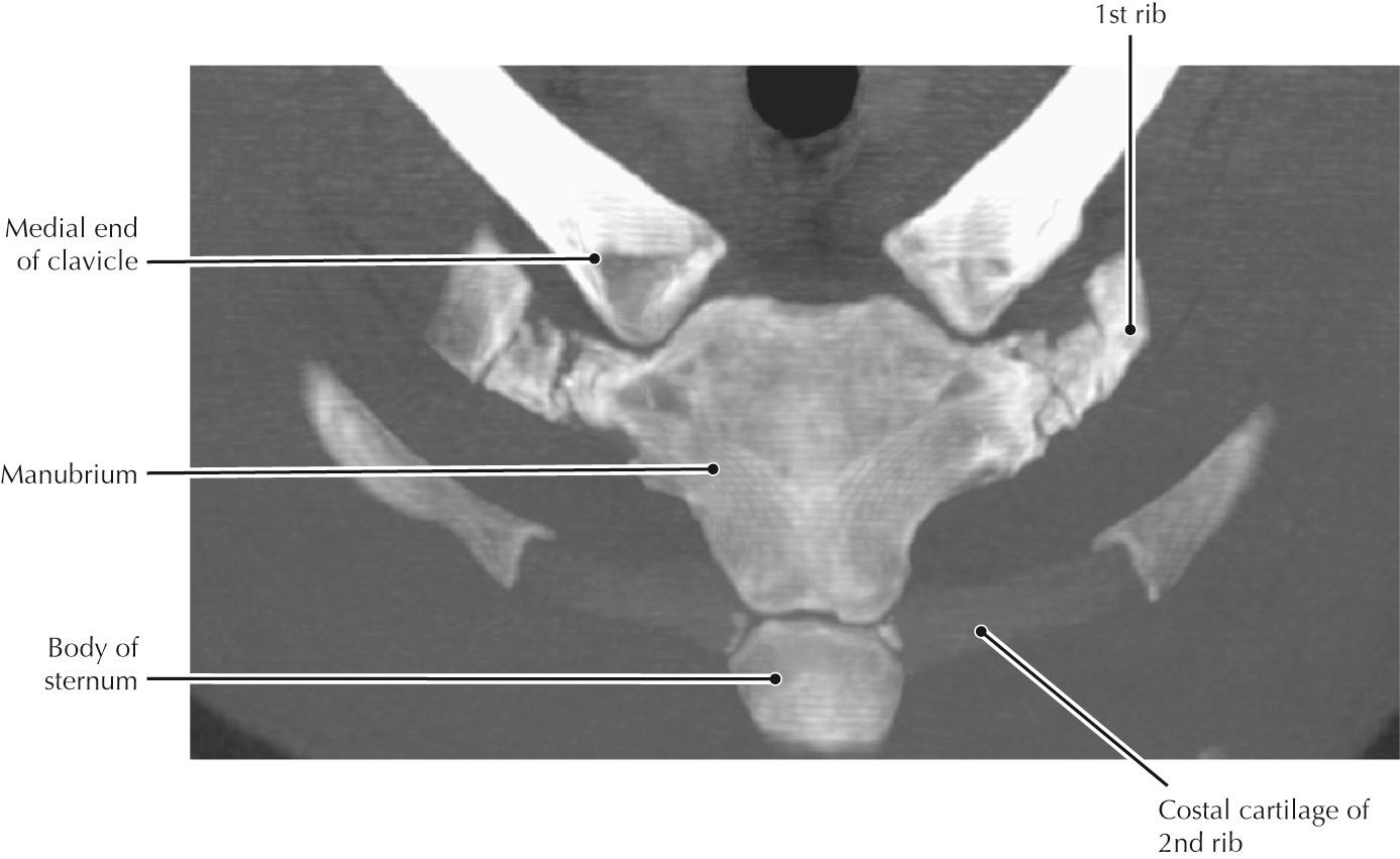 Upper Limb - Clinical Tree