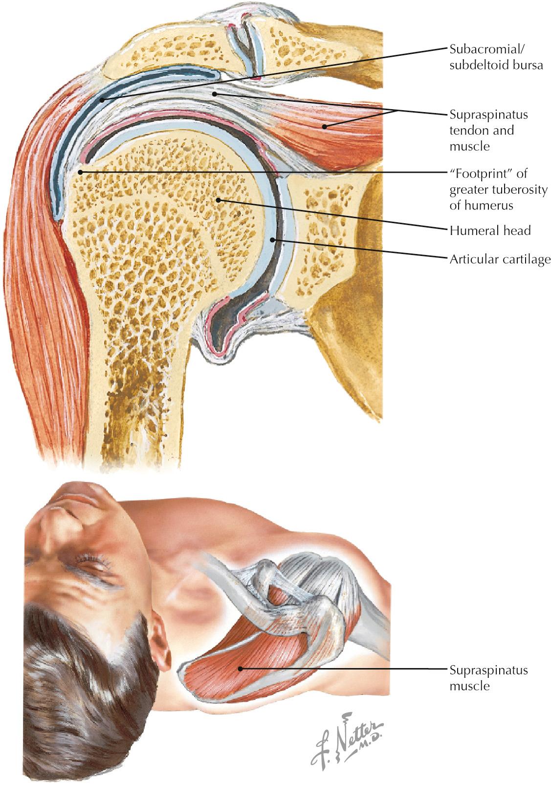 Upper Limb - Clinical Tree
