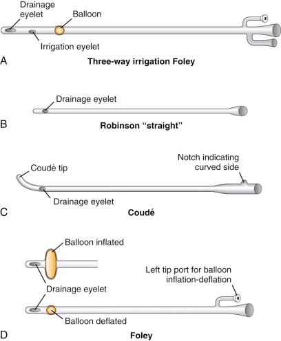 Urinary Catheterization - Clinical Tree