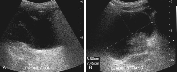 Urinary Tract Obstruction – Clinical Tree