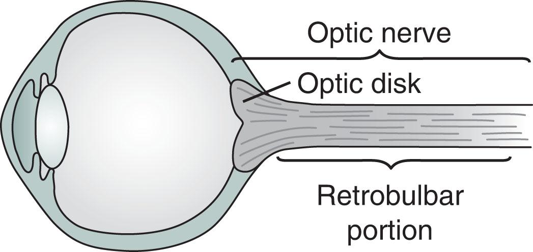 Visual Disturbances - Clinical Tree