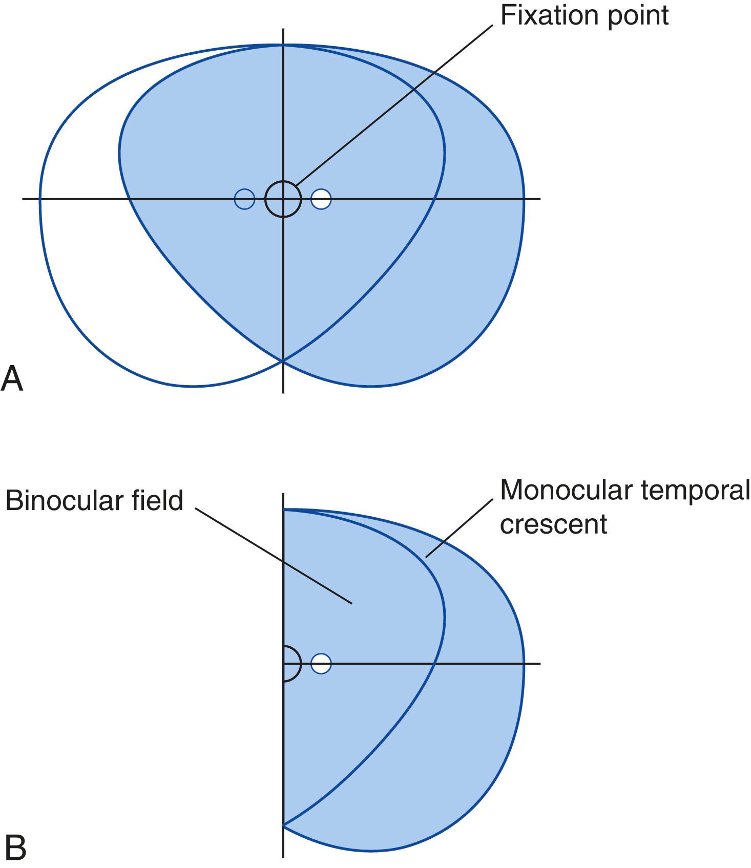 Visual Pathways - Clinical Tree
