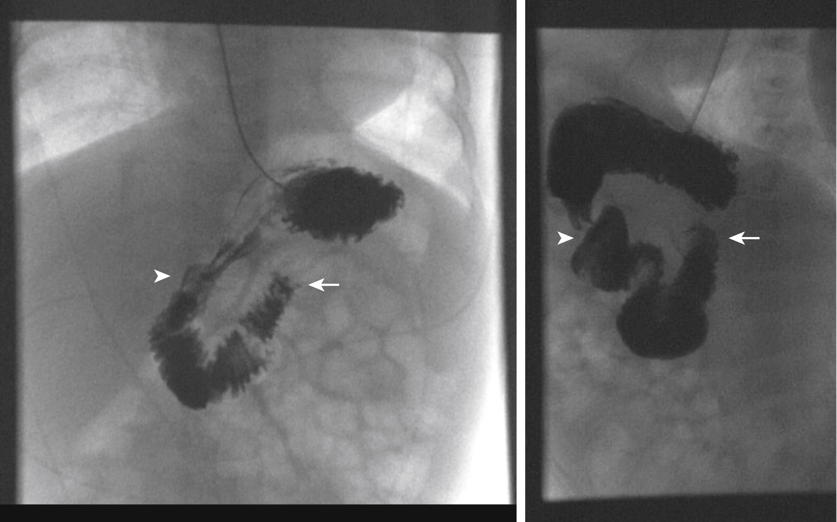Vomiting Infant - Clinical Tree