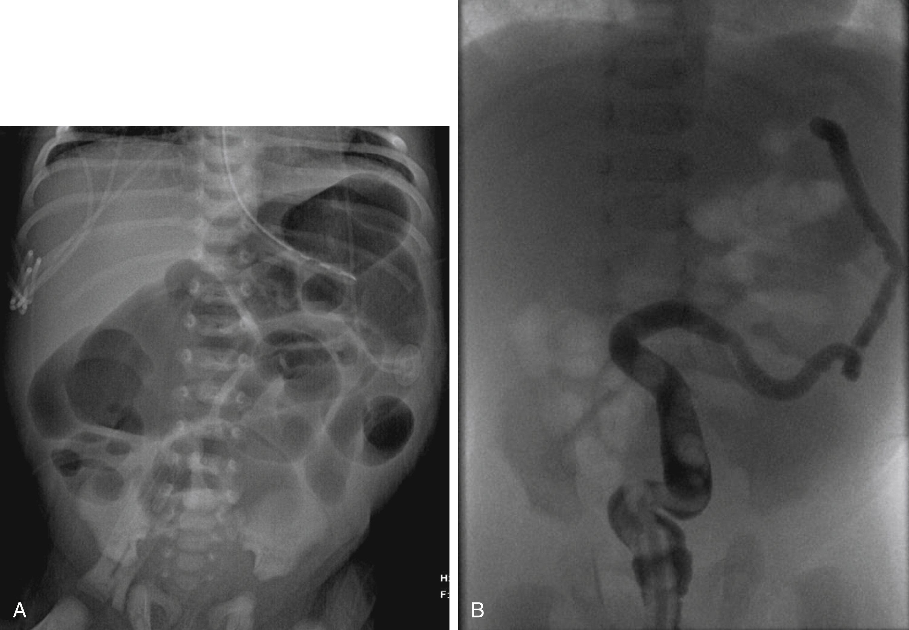 Vomiting Infant - Clinical Tree