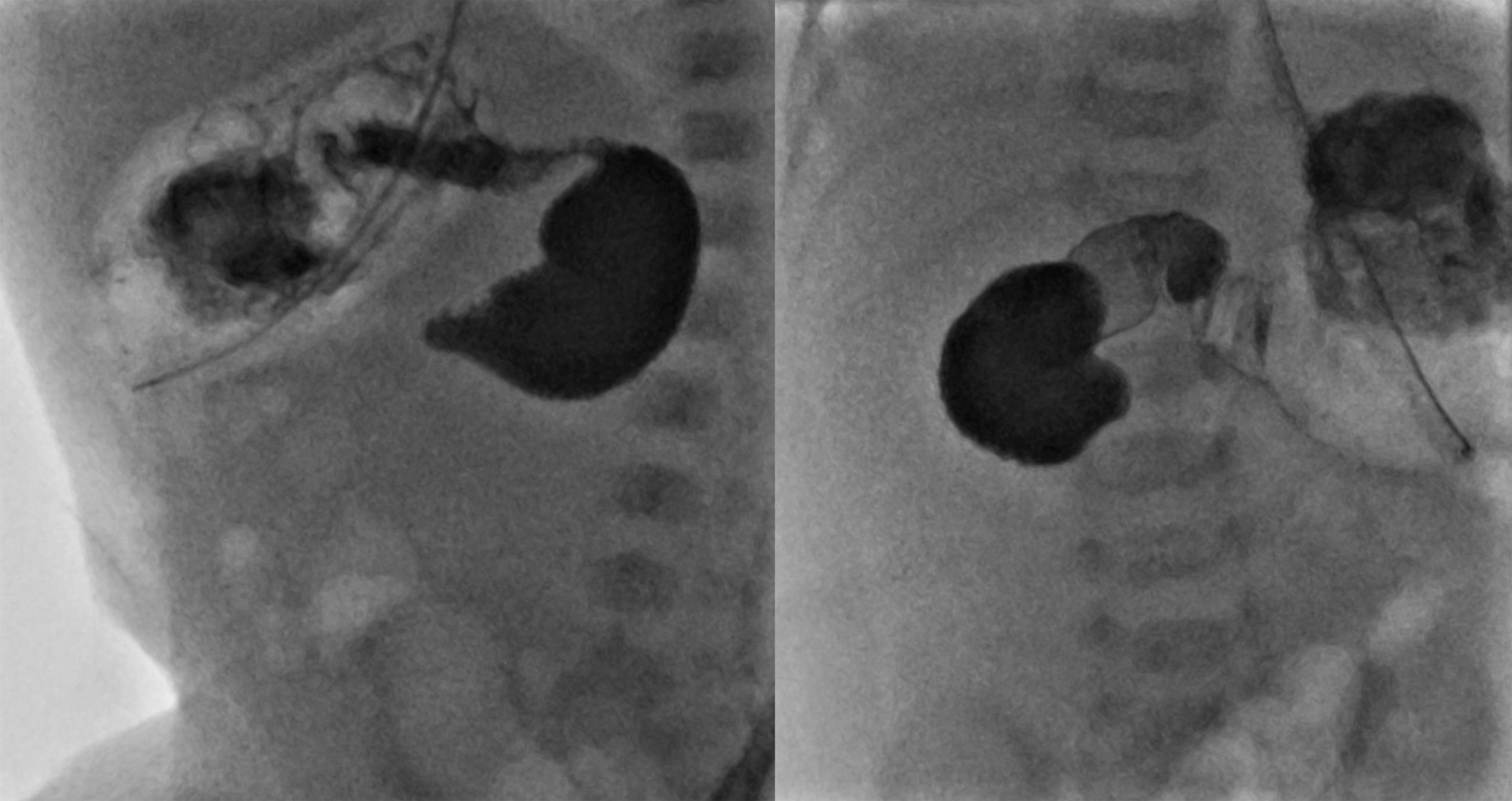 Vomiting Infant - Clinical Tree