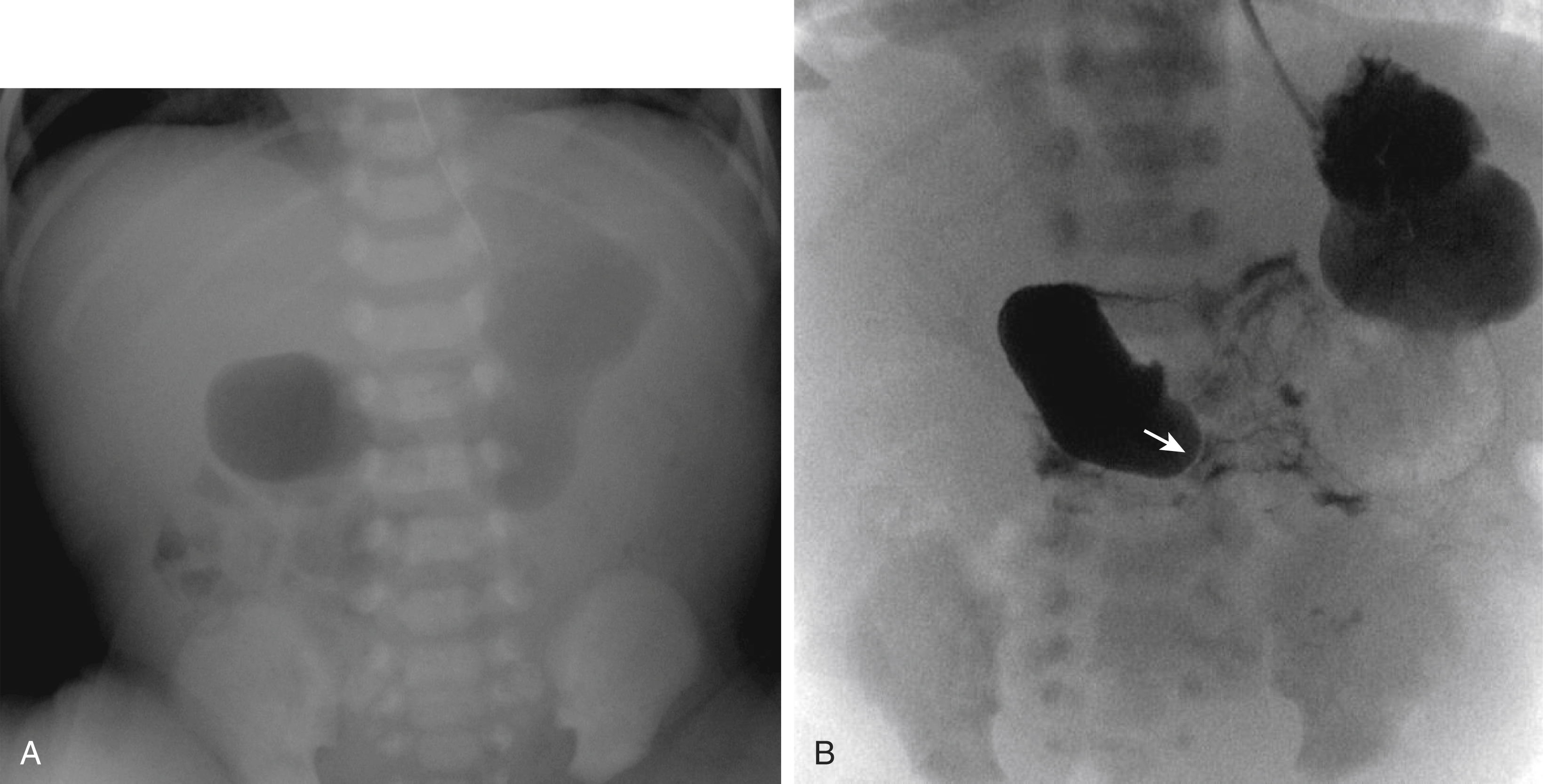 Vomiting Infant - Clinical Tree