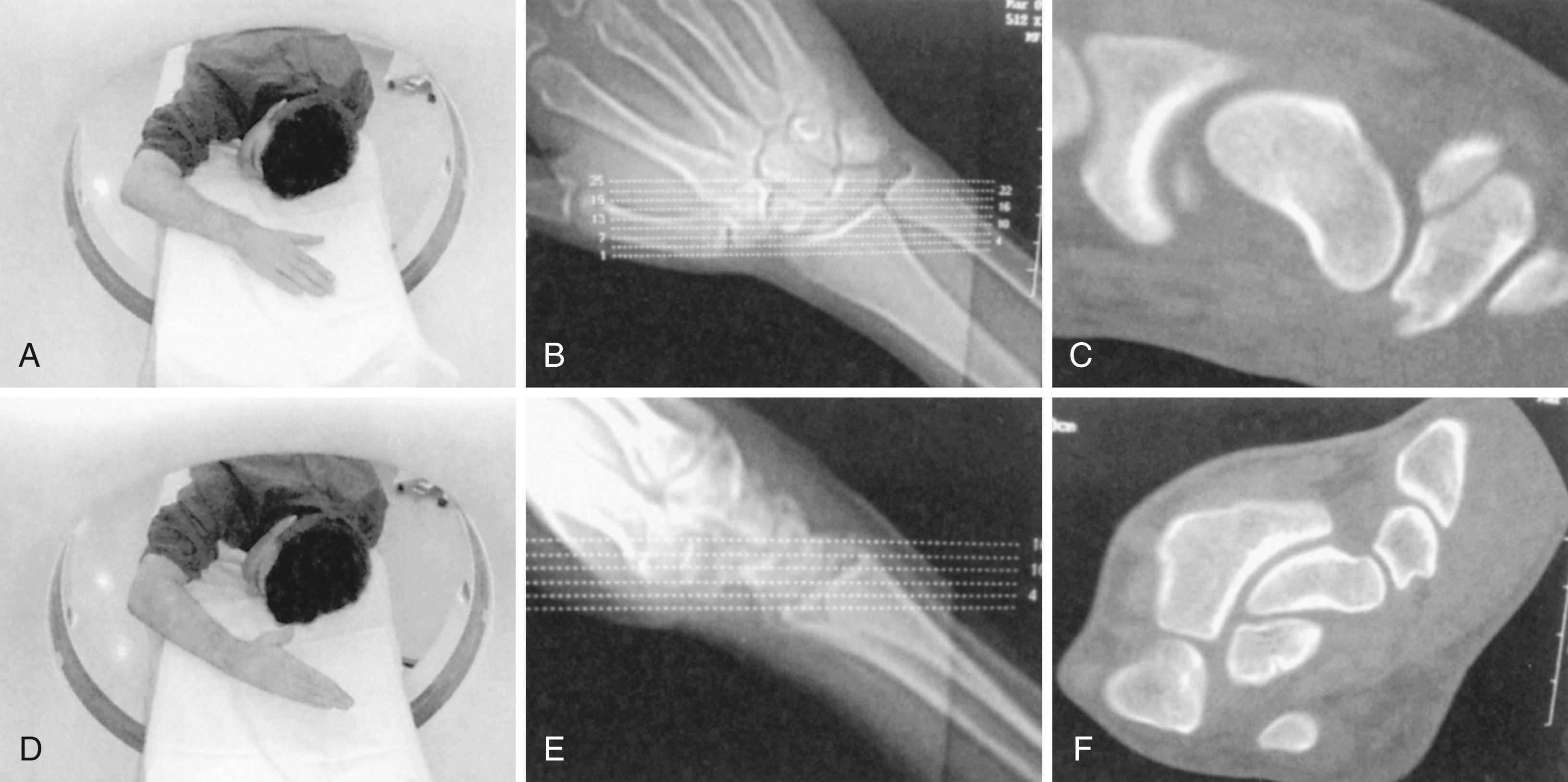 Wrist Disorders - Clinical Tree