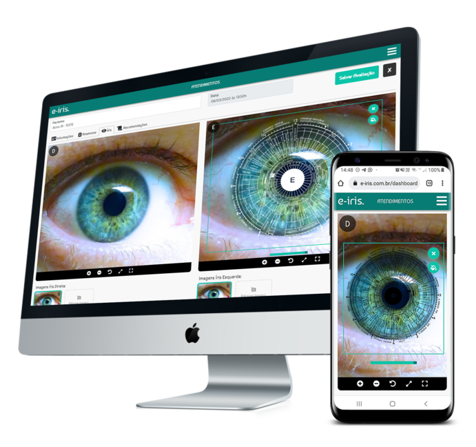 E-IRIS | Software para Iridologia
