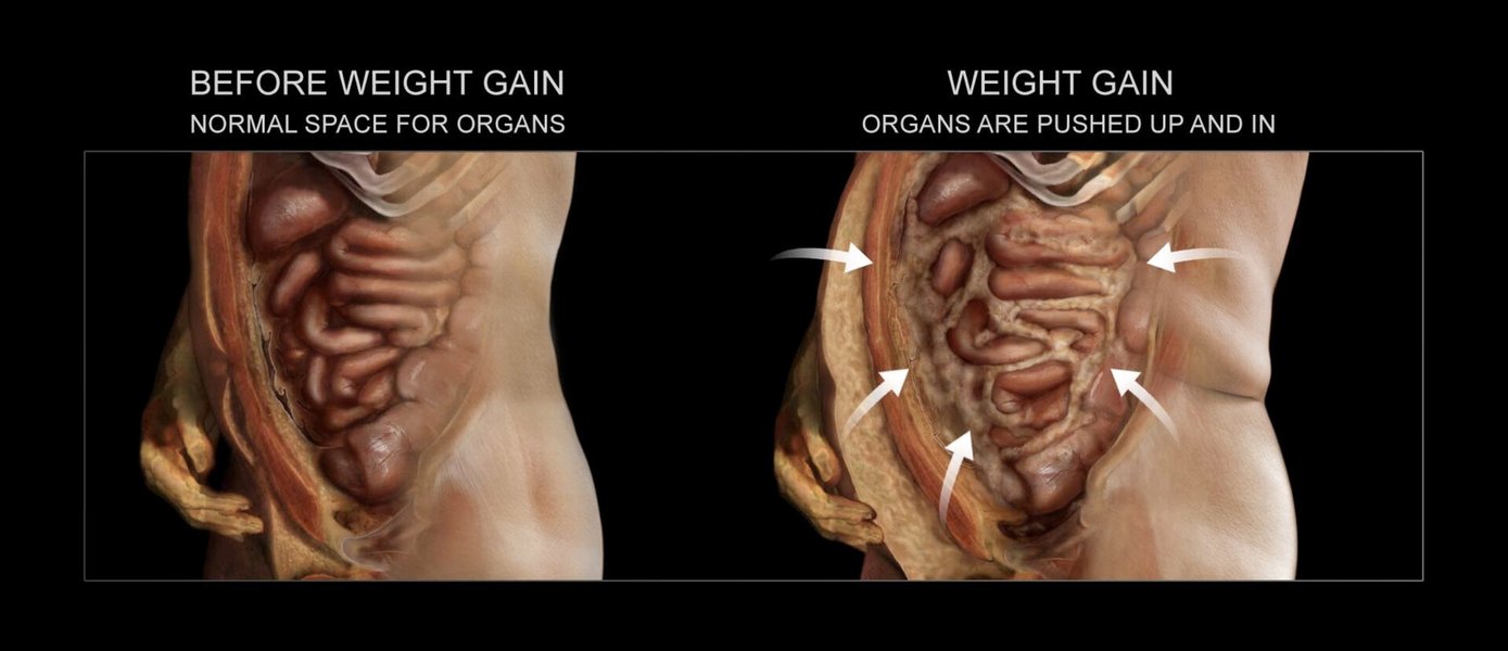 Ithy - Unpacking Your Belly Bulge: Beyond Just Fat
