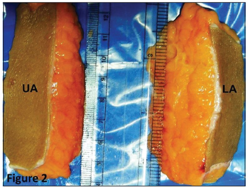 Ithy - Understanding the Body's Fat Storage Decisions