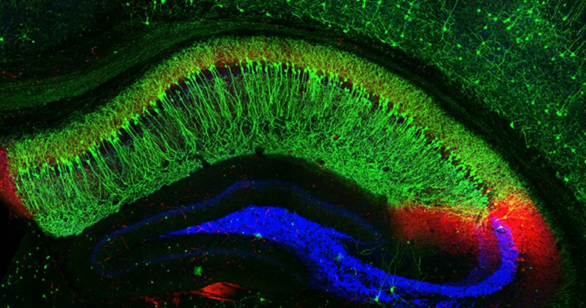 Ithy - Unlocking Memory: How CA1 Neuron Dendrites Divide and Conquer ...