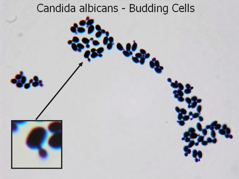 Ithy - Unveiling the Hidden Patterns of Candida in Clinical Isolates