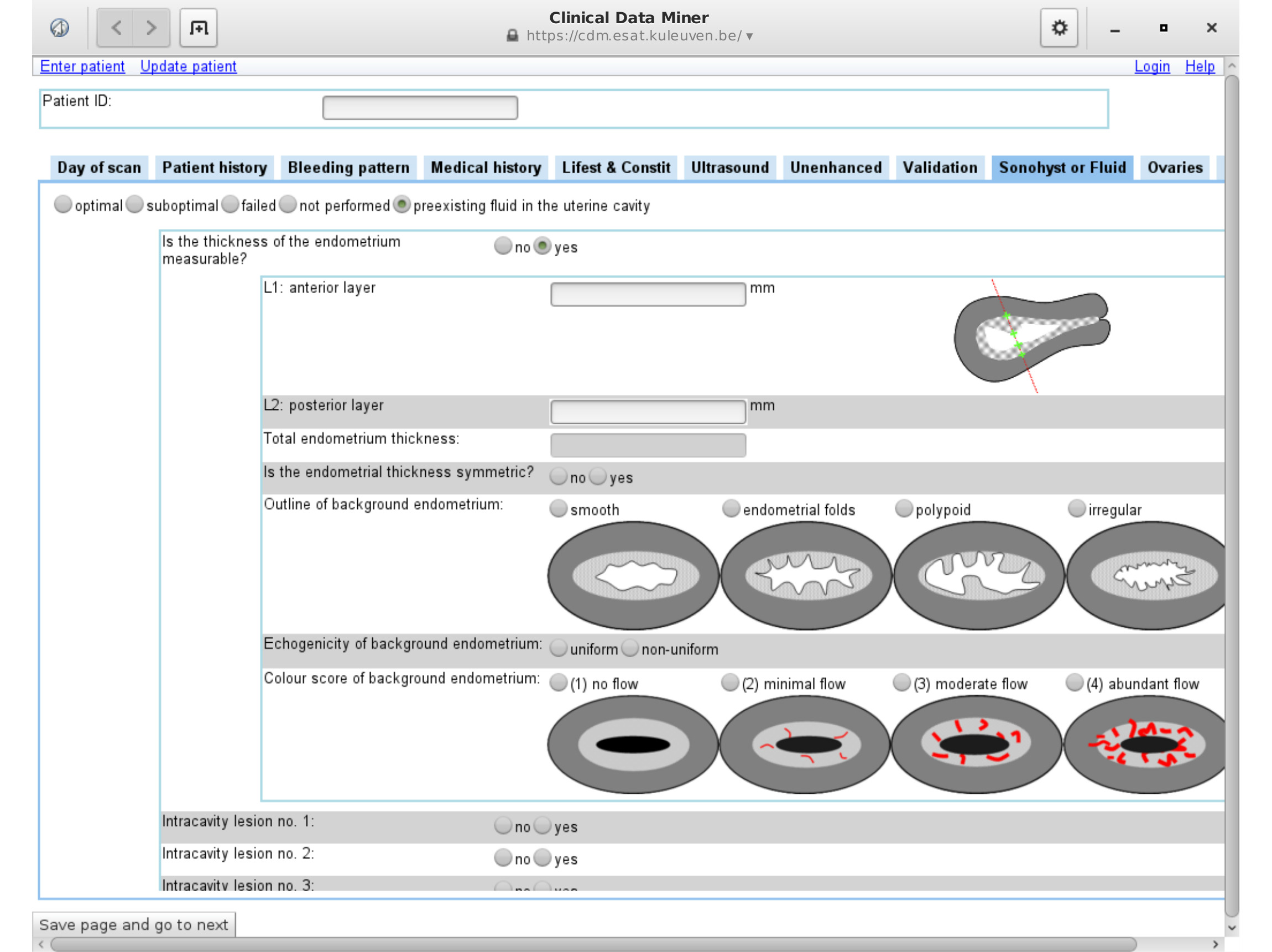 Ithy - Mapping CIBMTR Form Elements to OMOP Domain IDs