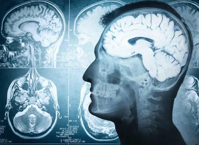 Ithy - Navigating the Labyrinth of the Mind: Understanding Common ...