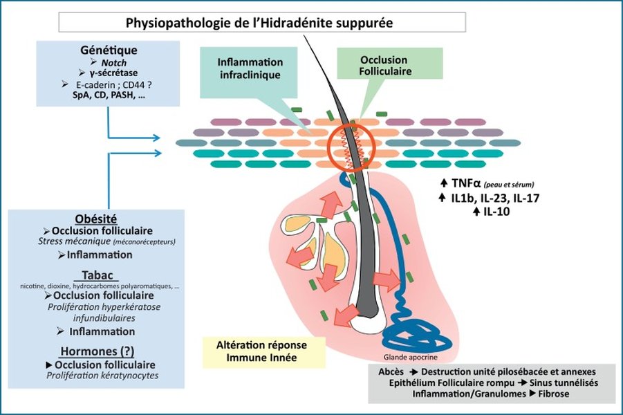 Ithy - Gestion du Risque d'Auto-Inflammation : Une Approche Cartographiée