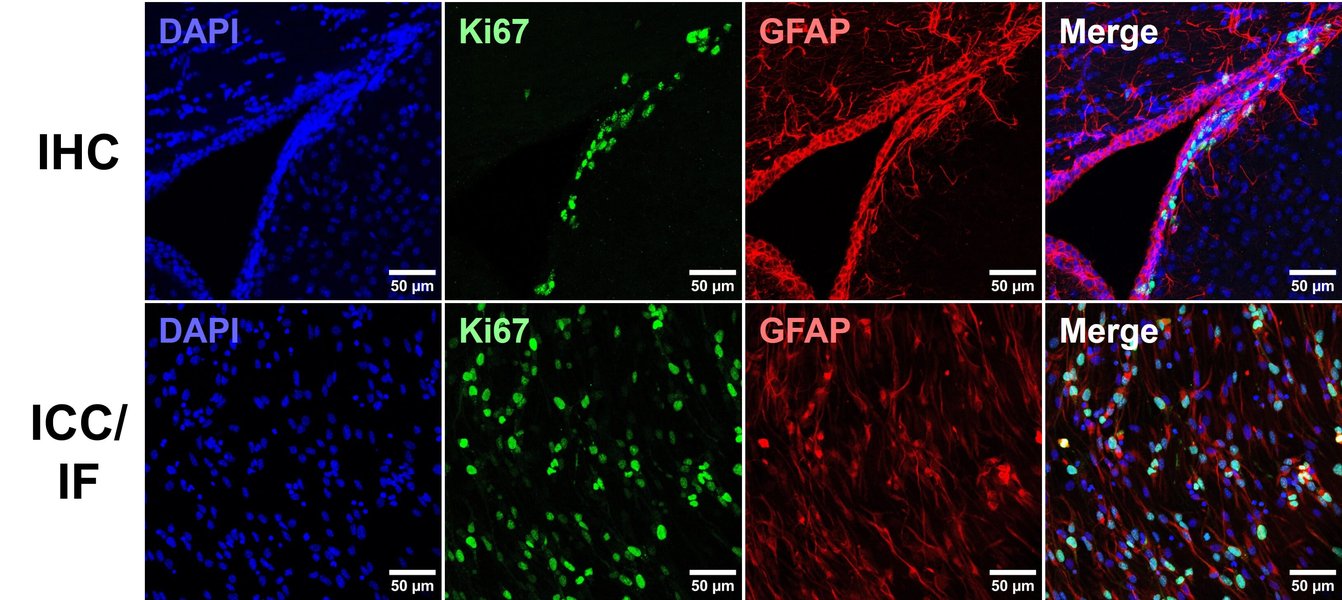 Ithy - 深入解析免疫組織化學染色原理：以小鼠腦組織的 Tyrosine Hydroxylase 標記為例