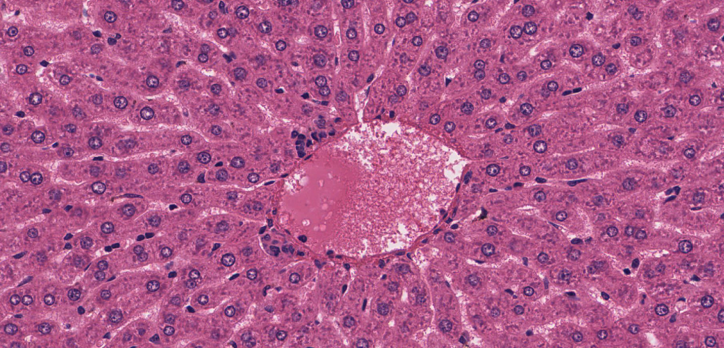 Ithy - Histopathological Analysis of Treated Liver Specimens