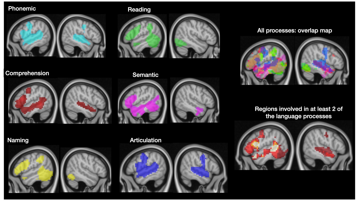 Ithy - The Role of Neurolinguistics in Speech and Language Disorders