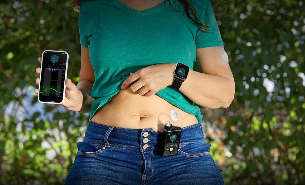 Ithy - Insulin Pumps Unveiled: Beyond Injections for Diabetes Management