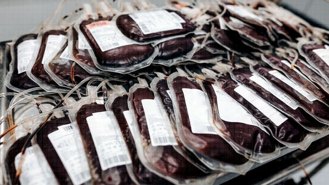 Ithy - Unveiling the Rarest Blood Types: Beyond the Common Eight