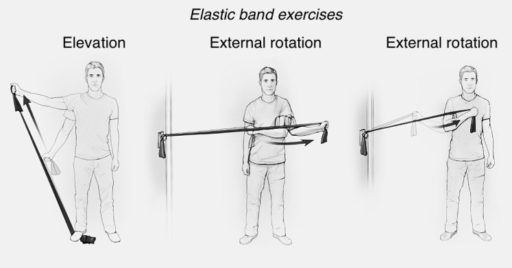 Ithy - Evidence-Based Exercise Recommendations for Recurrent Shoulder ...