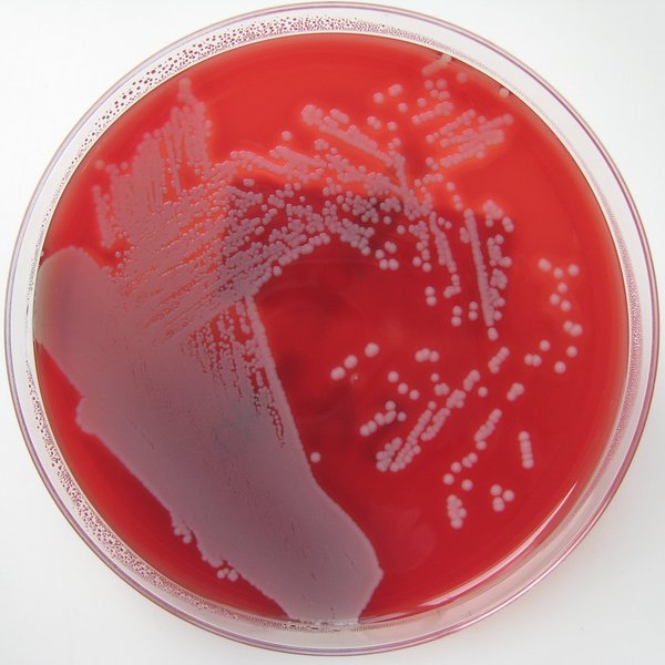 Ithy - Domina el diseño de antibiogramas para Staphylococcus aureus