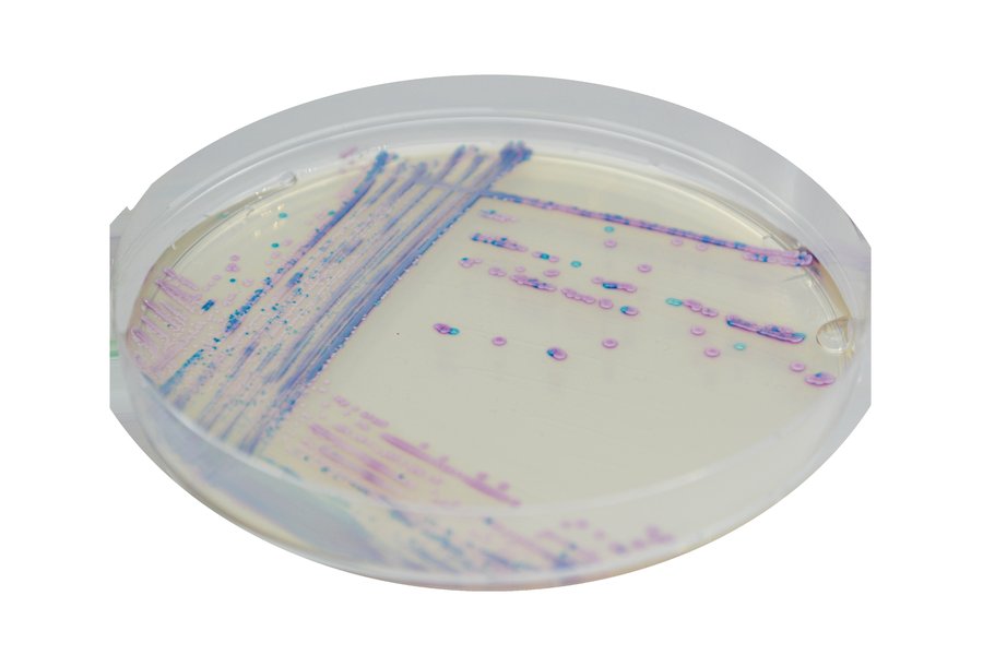 Ithy - Staphylococcus aureus: El Patógeno Dorado al Descubierto