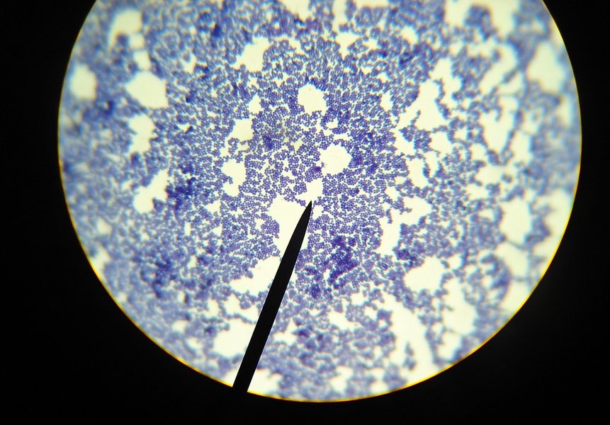 Ithy - Staphylococcus aureus: El Patógeno Dorado al Descubierto