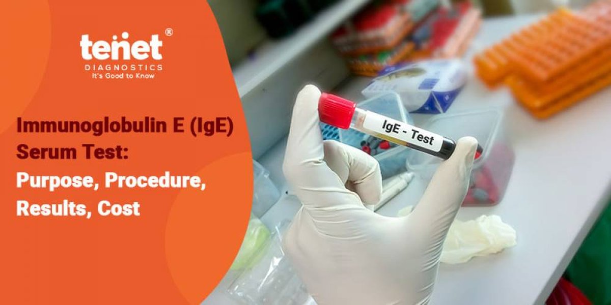 Ithy - Unlocking the Secrets of Total Immunoglobulin E: Your Body's ...