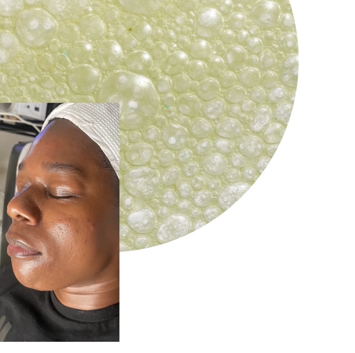 Before and After Social Post