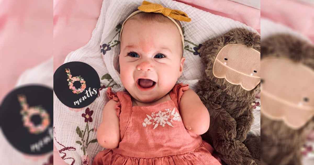 4-Year-Old Disabled Girl's Reaction To Dad's Homecoming Will Warm Your ...