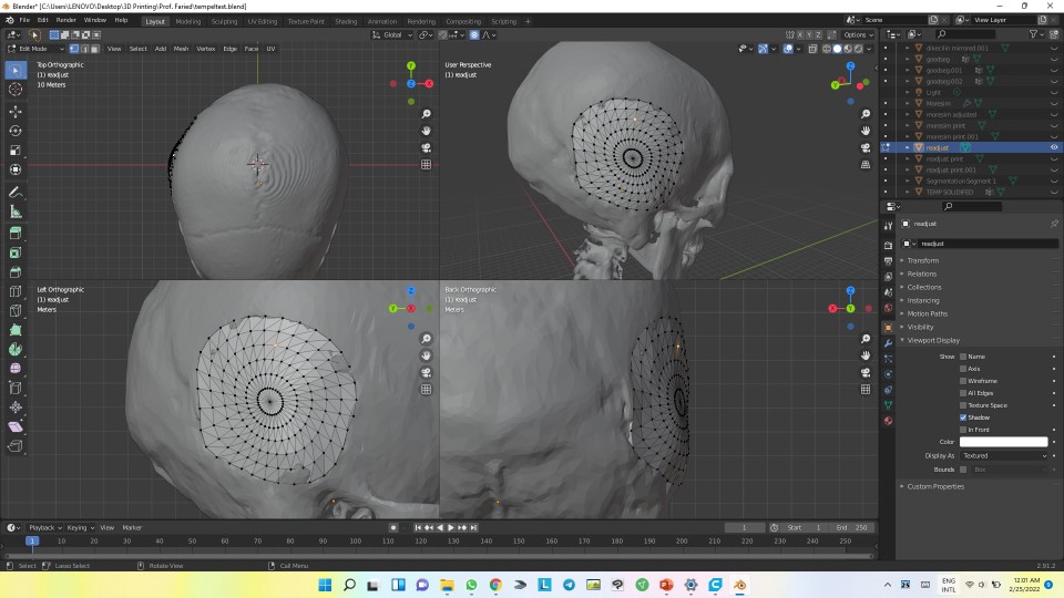 Splicing/Slicing/Ekstraksi Model 3D Medis dari Hasil Pencitraan/Imaging ...