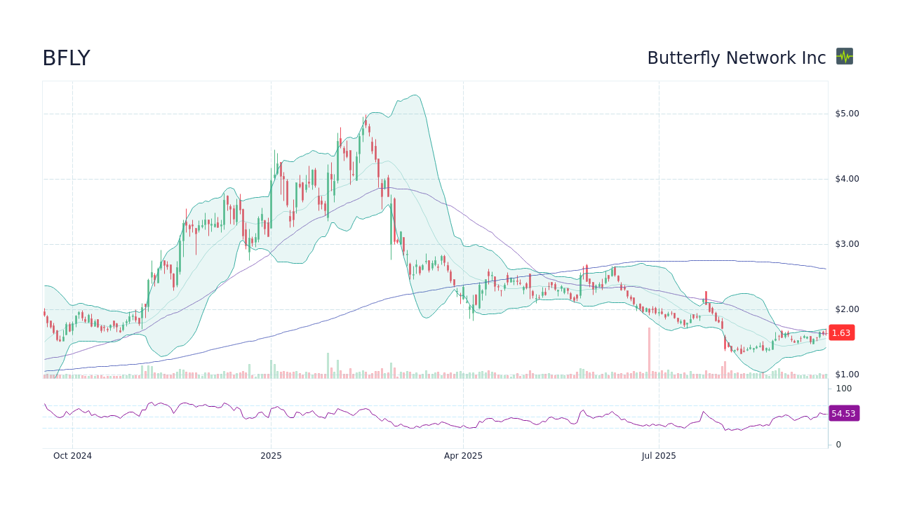 Butterfly Network Inc【BFLY】：株価・チャート - StockScan