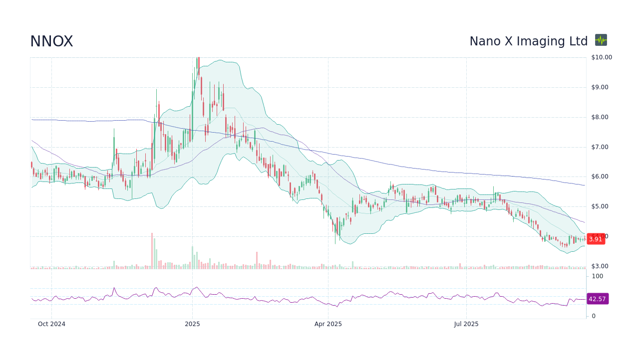 NNOX - Nano X Imaging Ltd Stock Price Forecast 2025, 2026, 2030 to 2050 ...