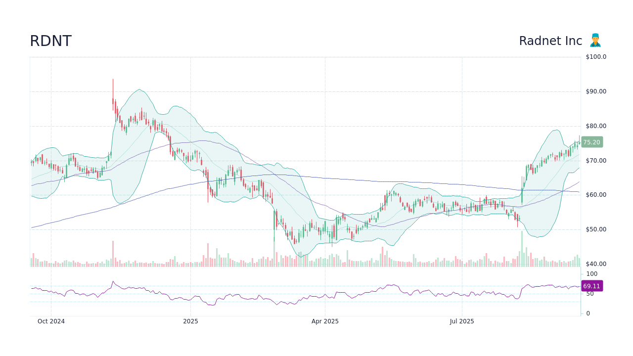 RDNT - Radnet Inc 株価 今後・予想 - StockScan