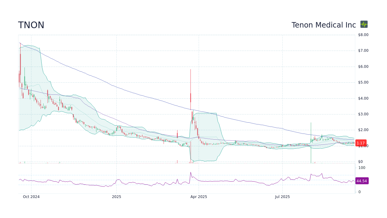 TNON Stock Price - Tenon Medical Inc Stock Candlestick Chart - StockScan