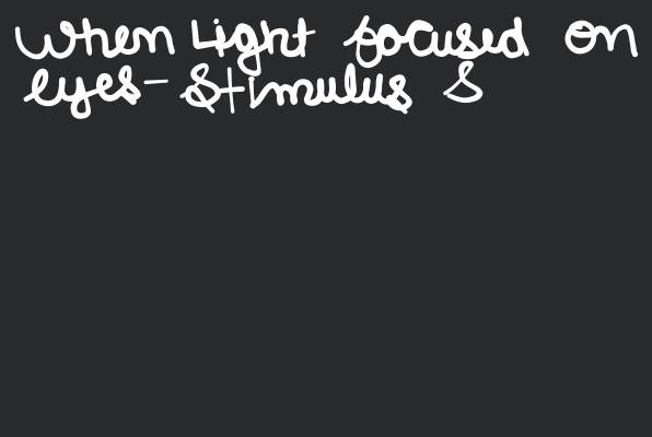 Trace the sequence of events which occur when a bright light is focused o..