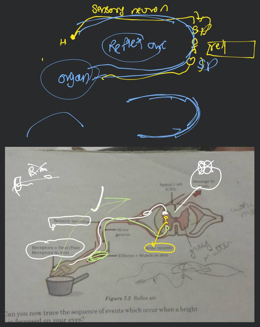 Trace the sequence of events which occur when a bright light is focused o..