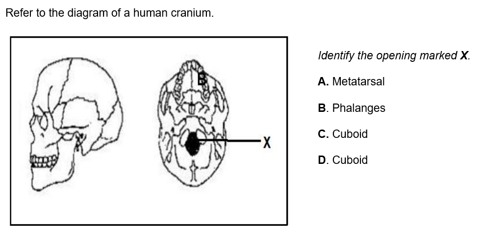 Refer to the diagram of a human cranium. Identify the opening marked X.