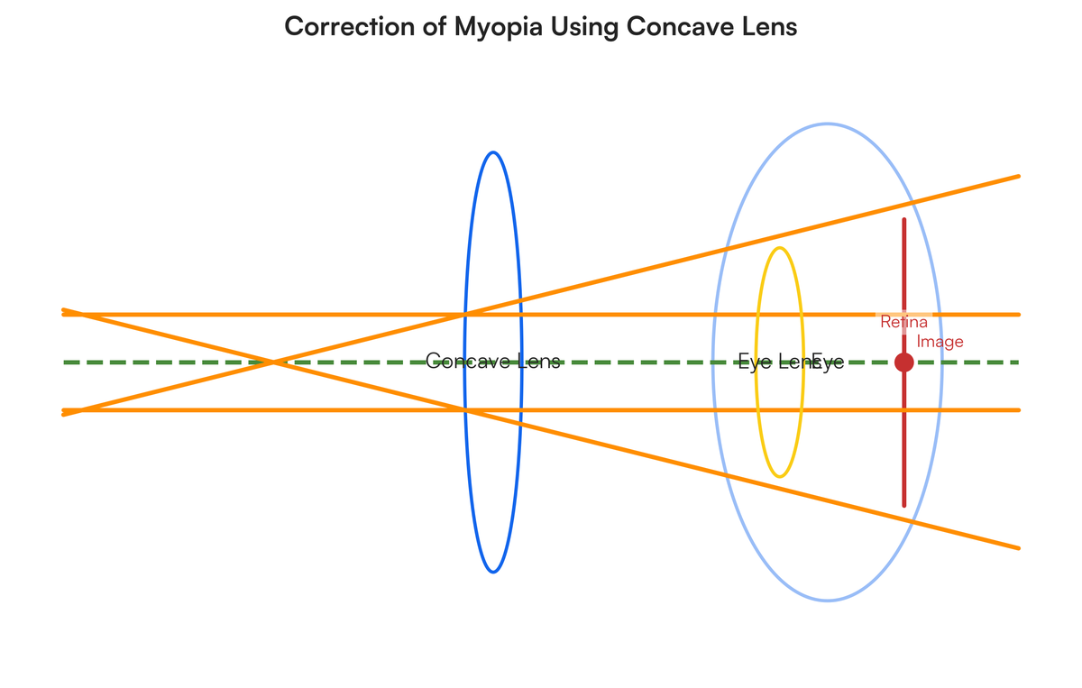The above image shows the lens is placed on the axis A. Which type of the..