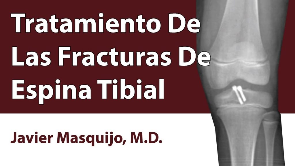 Tratamiento De Las Fracturas De Espina Tibial - Global HELP Tratamiento De Las Fracturas De Espina Tibial - Global HELP
