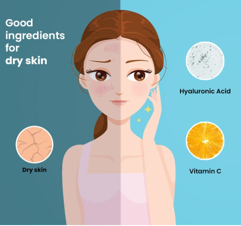 Dry skin: causes, treatment & routine for dry skin