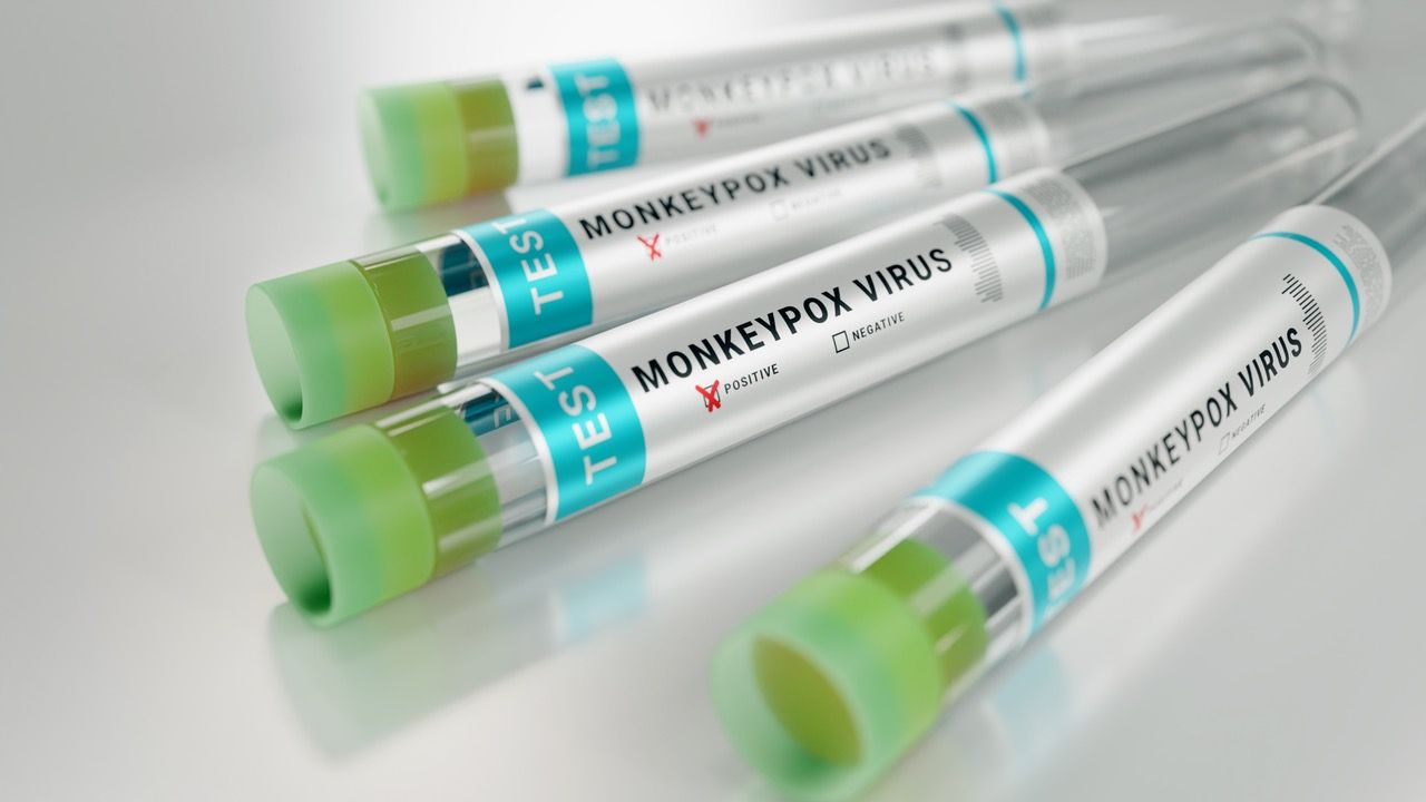 Monkeypox Health Crisis: How California is Responding | Hayti - News ...